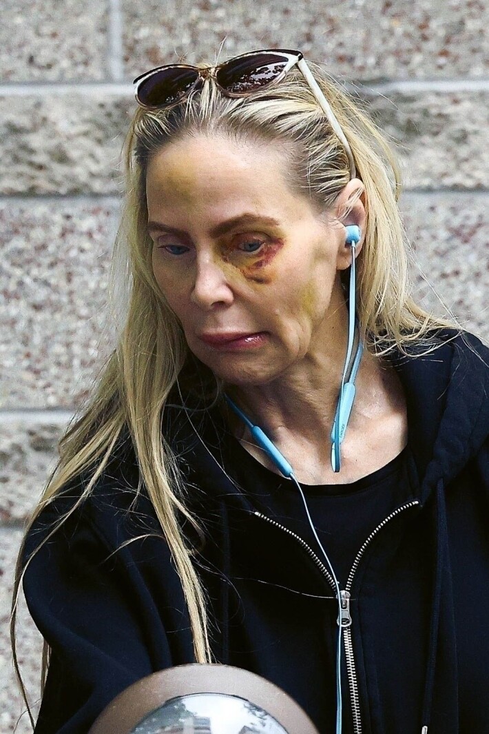 Nicolas Cagen poikaa syytetään äitinsä pahoinpitelystä - järkyttävät ...