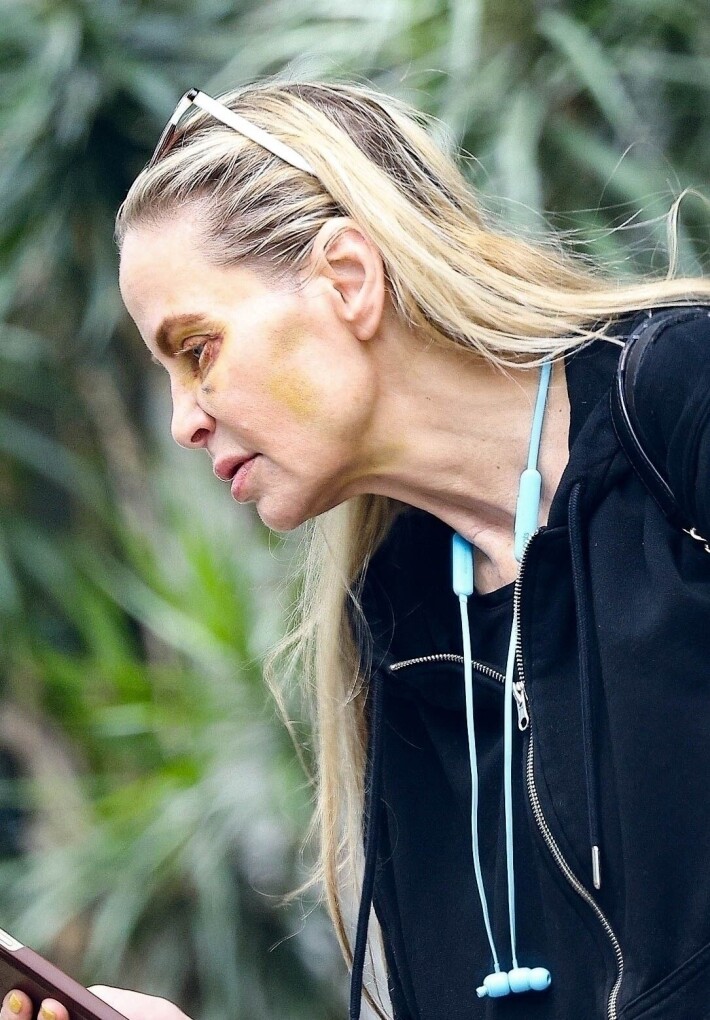 Nicolas Cagen poikaa syytetään äitinsä pahoinpitelystä - järkyttävät ...